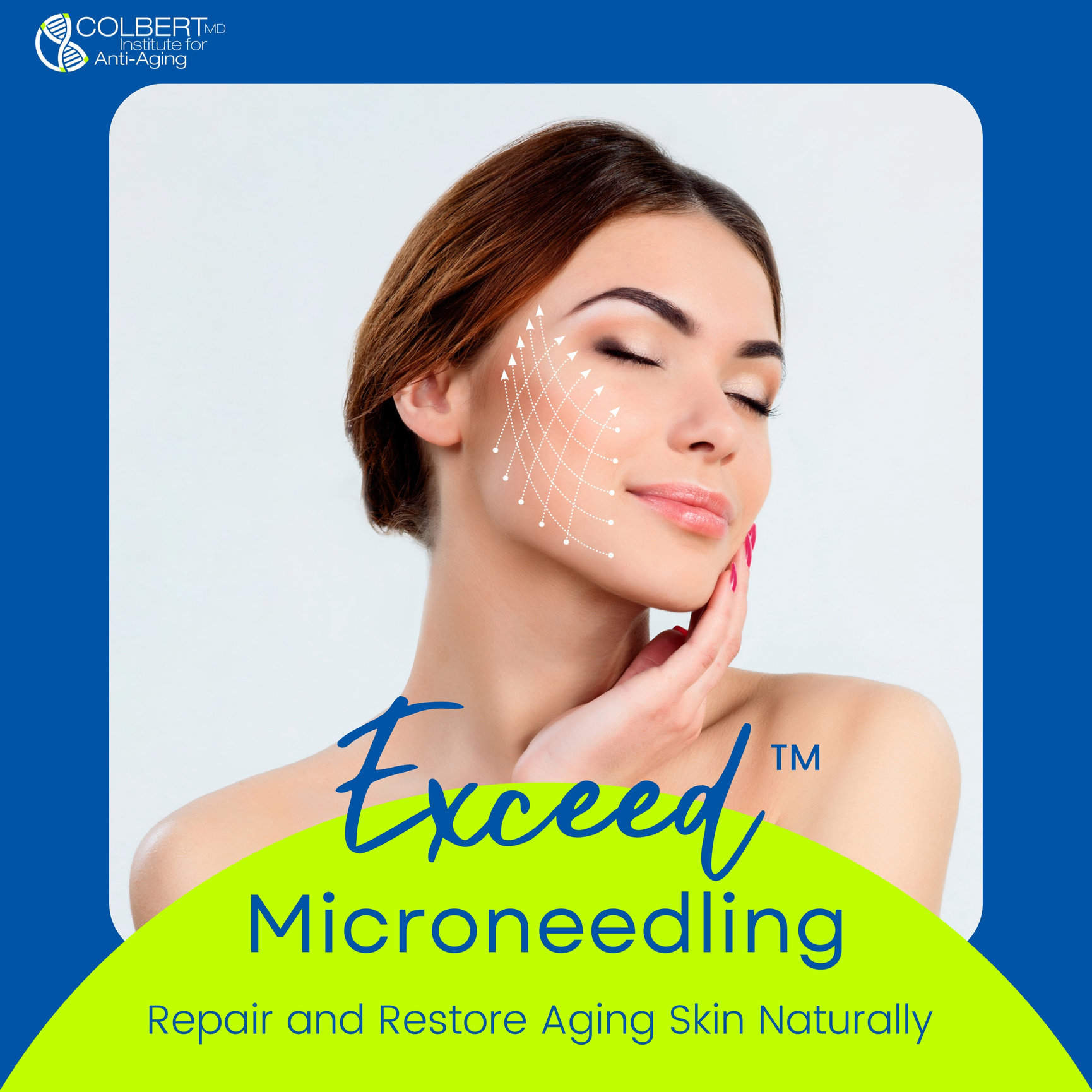 Exceed Microneedling - Colbert Institute of Anti Aging