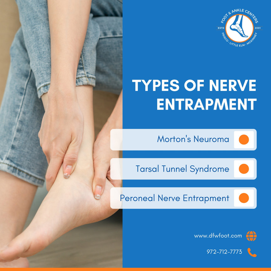 Nerve Entrapment Foot & Ankle Centers Mckinney Texas